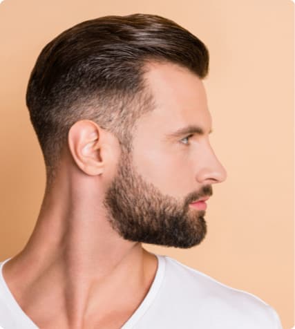 Entradas no cabelo: é normal ou é calvície? Saiba a resposta